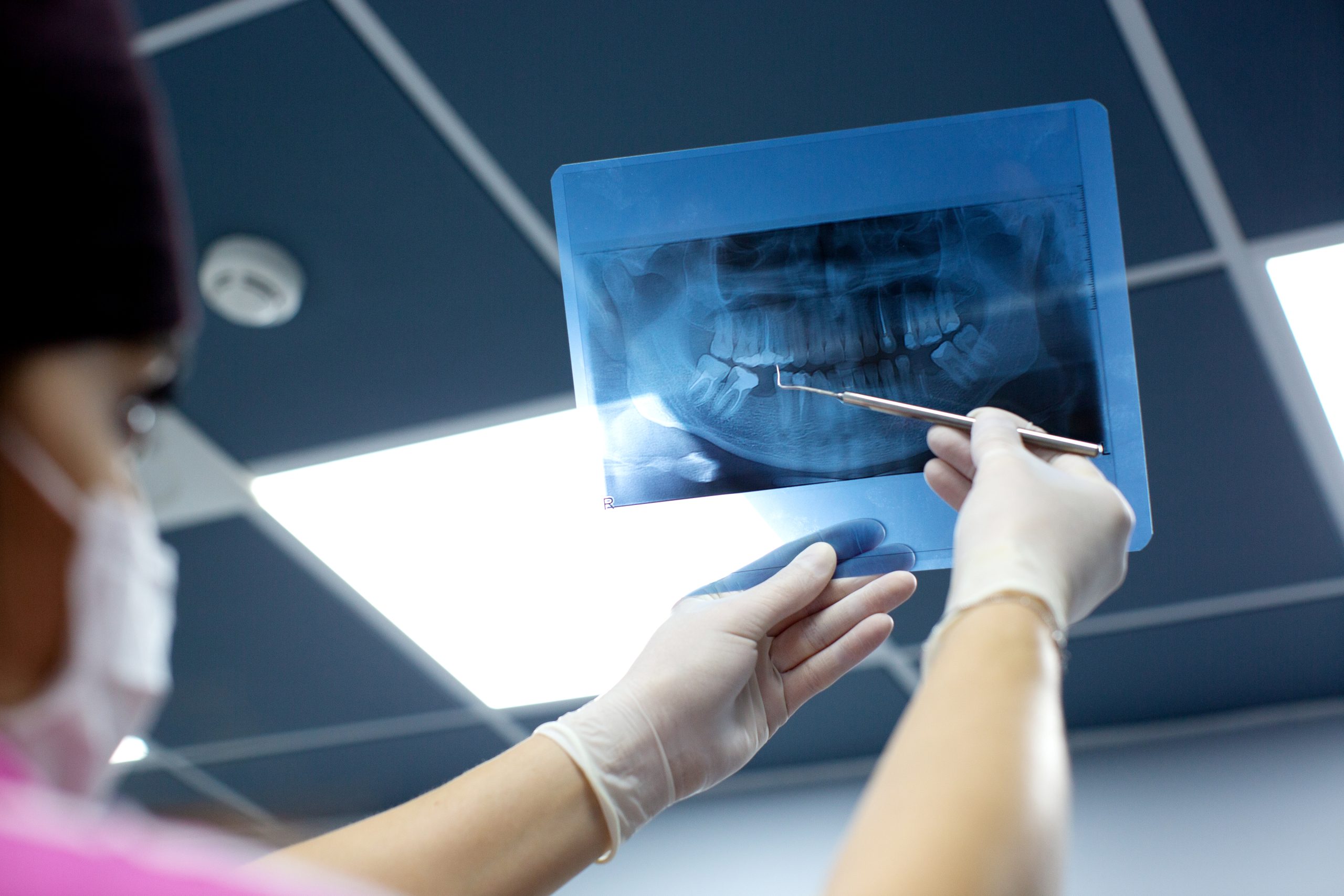 Micro-computed tomography of tooth tissue volume changes following ...